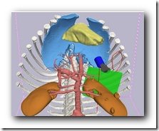 3D Slicer – Open Source Software for CT and MRI Radiology - Medical Quack